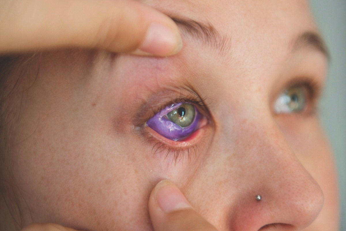 Law would prohibit eye tattoos in Washington state | Courier-Herald